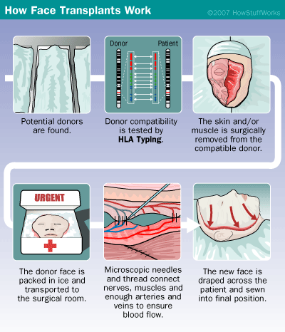 TheMorbidlyFascinatingPageFaceTransplants